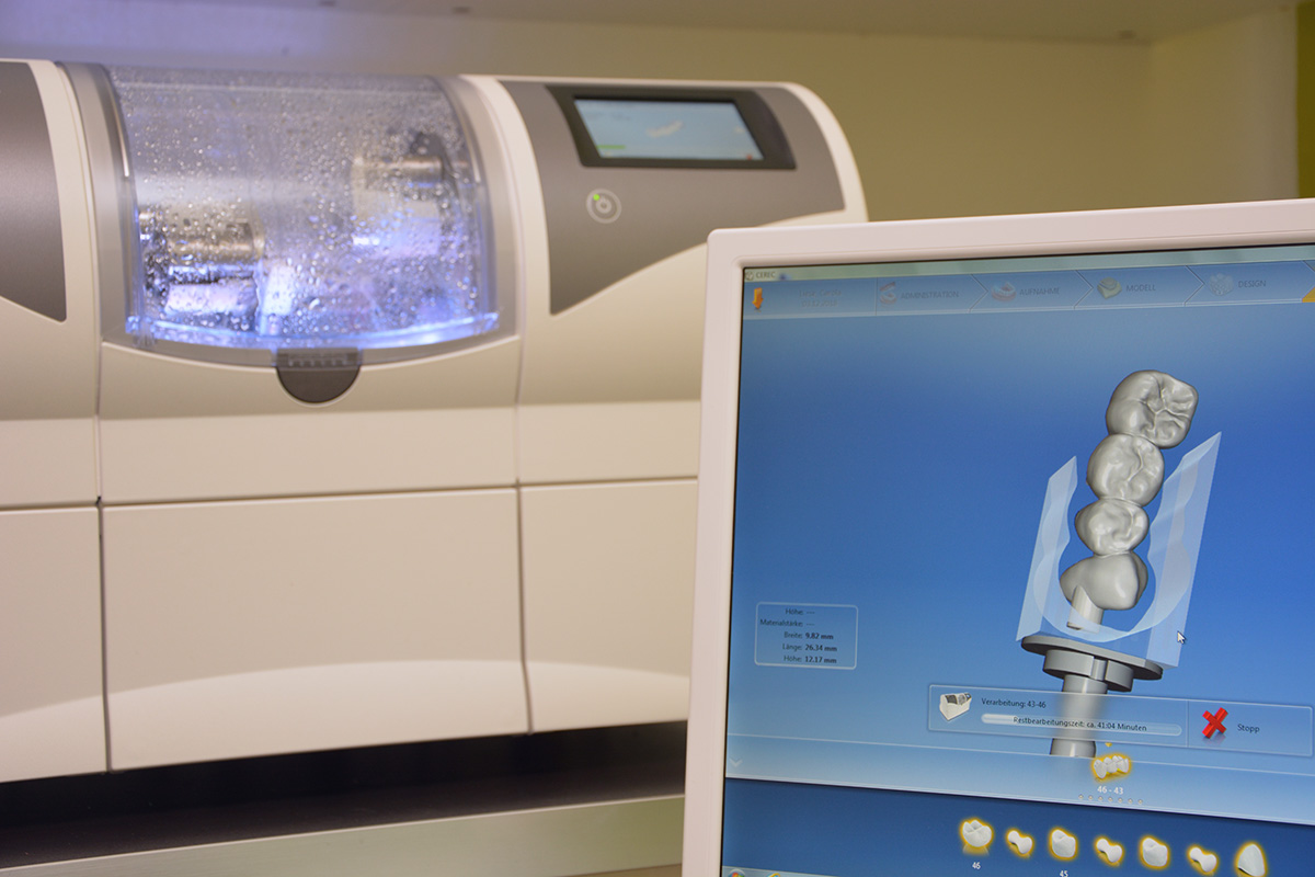 CEREC – Zahnersatz in einer Sitzung | Zahnarzt Rehberg
